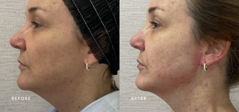 ATTIVA - Jenna Queller, MD